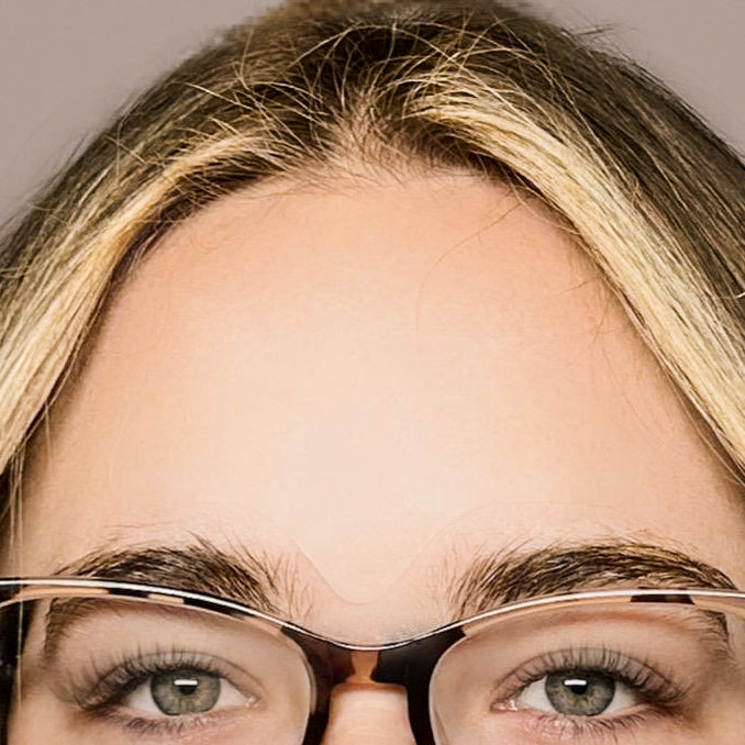 Pimple Patch Full Face – 15 Hydrocolloid Patches for Chin, Cheeks, Nos